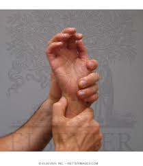 تمزق غضروف المعصم Triangular Fibrocartilage Complex (TFCC) Tear ...